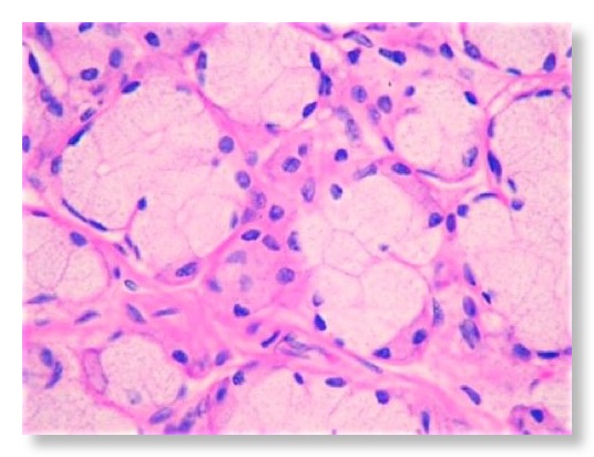 Oral Histology Digital Lab Glands Secretory Acini Image 1